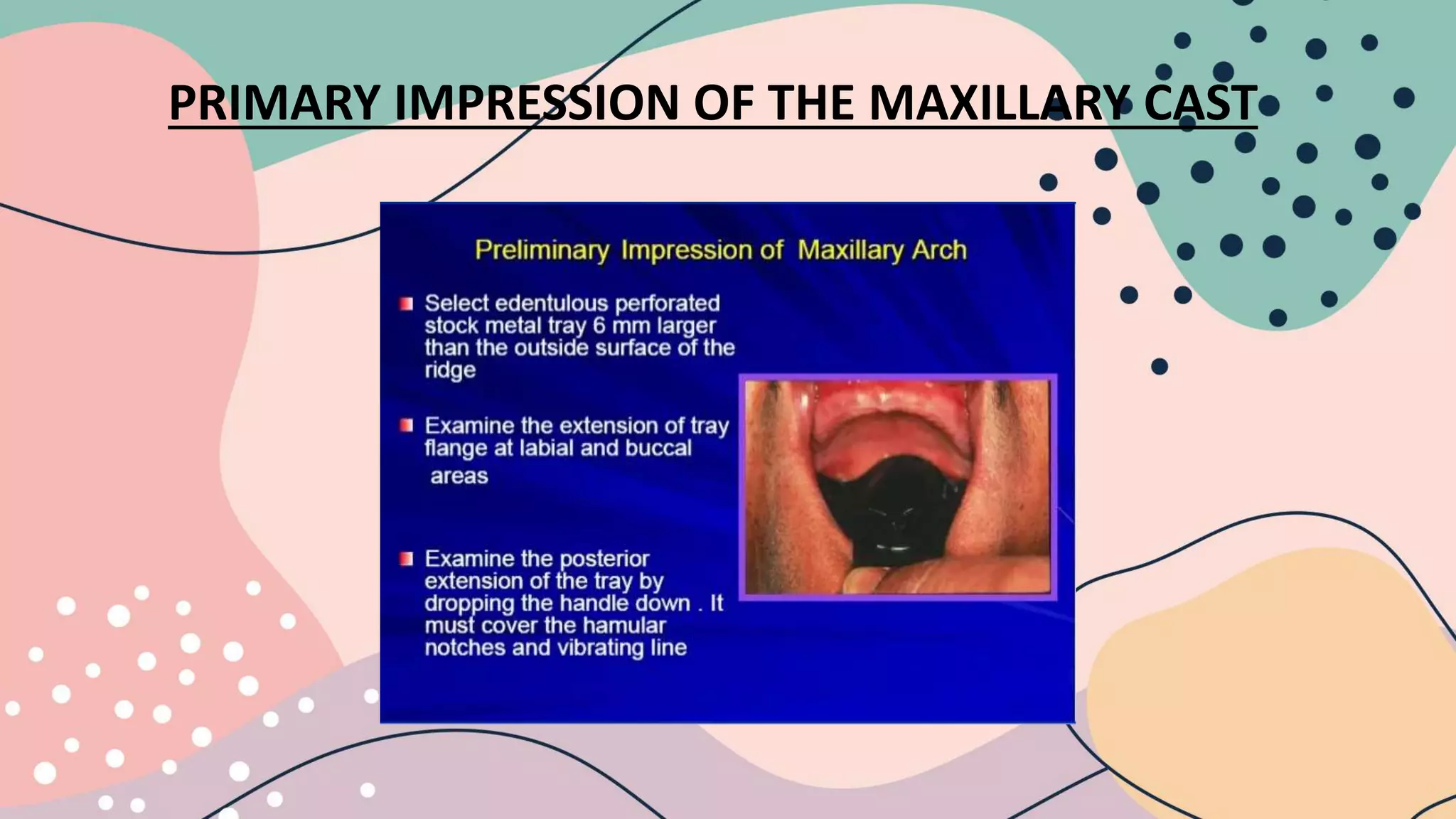 Clinical steps in impression making using ZOE {maxillary cast} | PPT