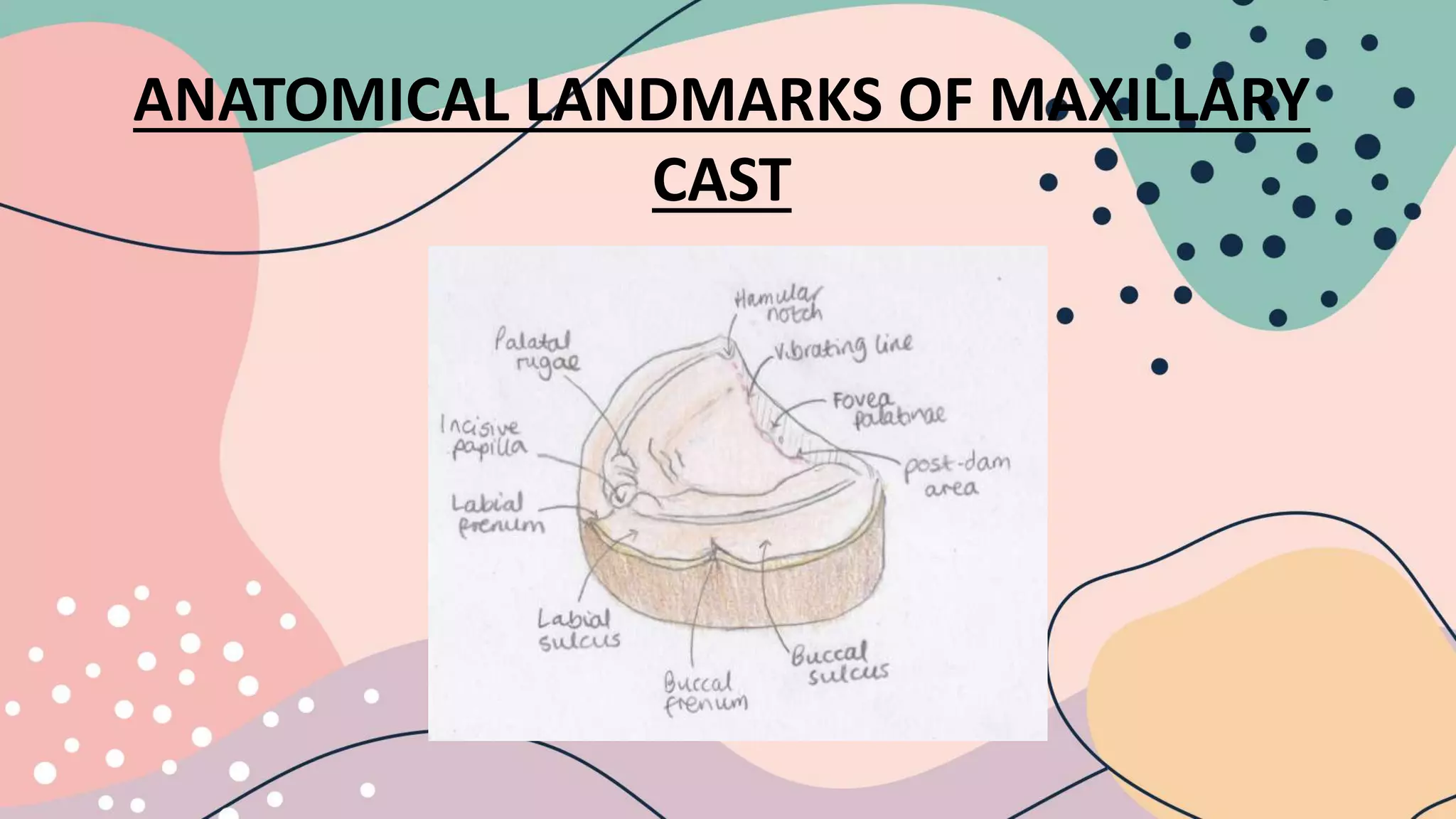Clinical steps in impression making using ZOE {maxillary cast} | PPT