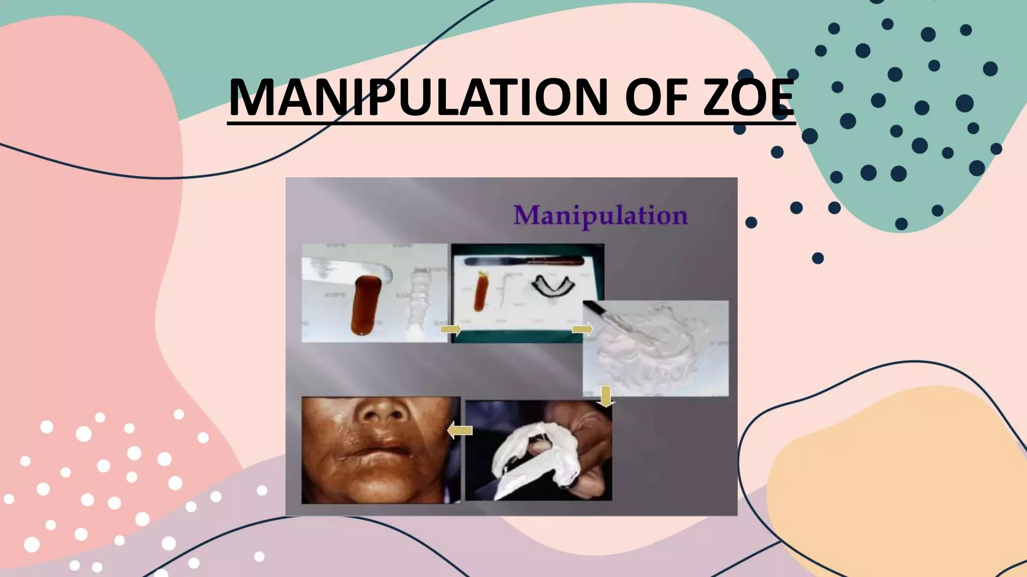 Clinical steps in impression making using ZOE {maxillary cast} | PPT