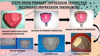 Clinical steps in impression making using ZOE {maxillary cast} | PPT