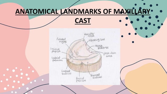 Clinical steps in impression making using ZOE {maxillary cast} | PPT