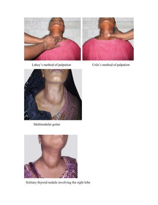 Clinical surgery(History & Physical) | PDF