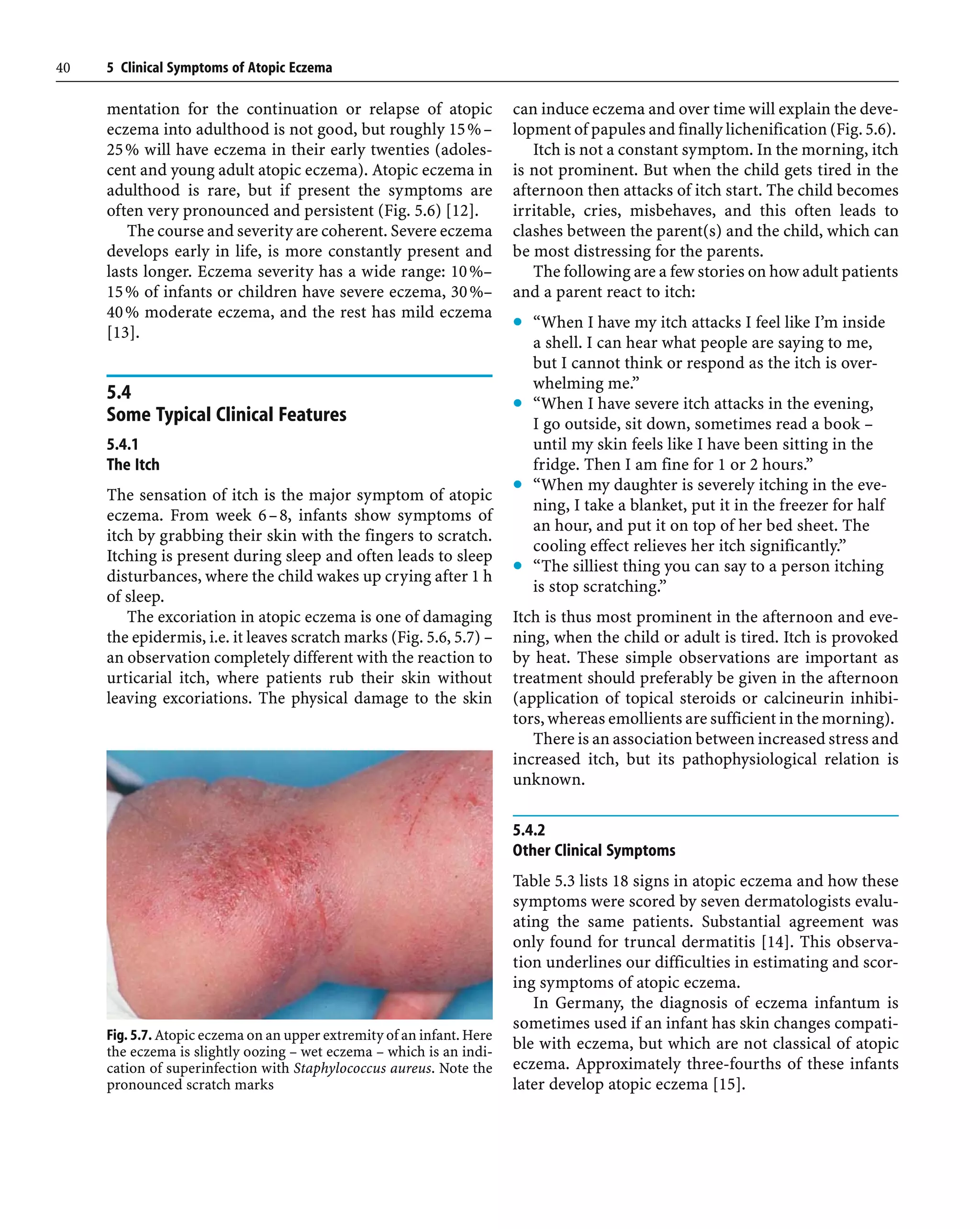 Clinical symptoms of eczema | PDF