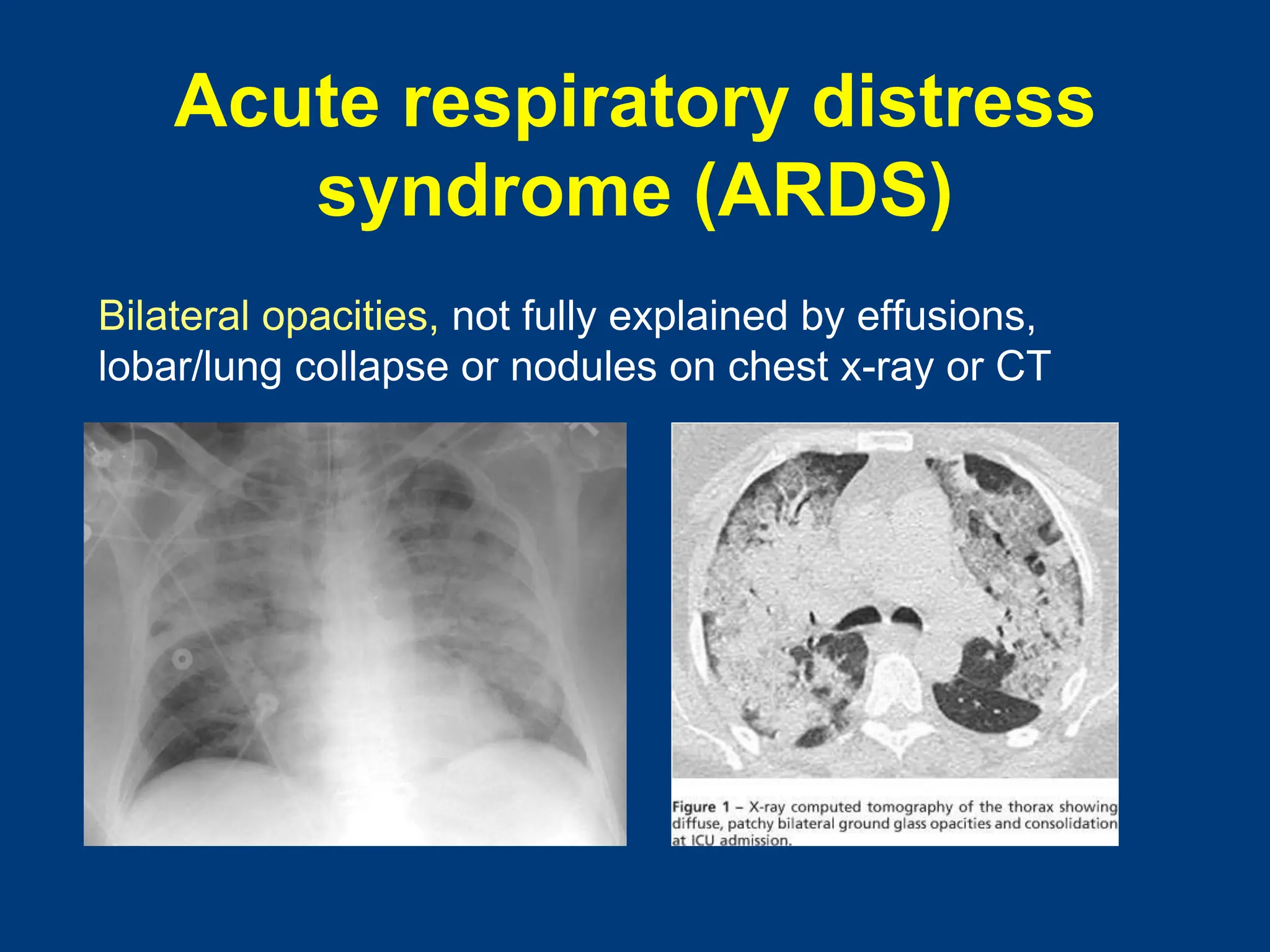 clinical syndrome (1).pptx