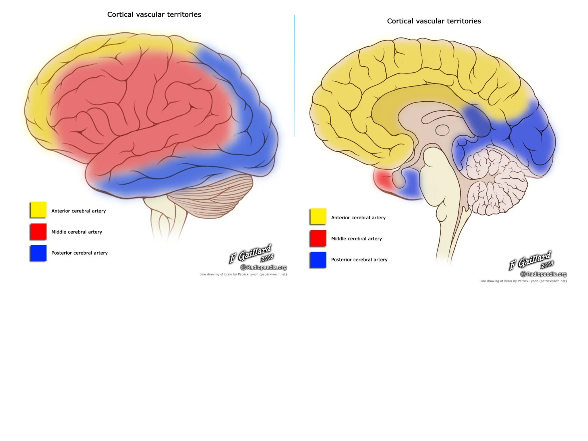 Clinical Syndromes of Cerebral Ischemic Stroke pp.pptx