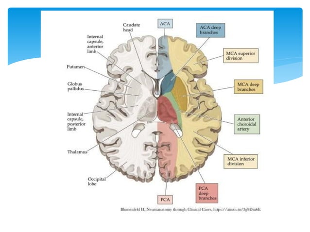 Clinical Syndromes of Cerebral Ischemic Stroke pp.pptx
