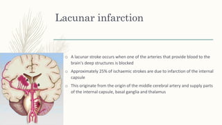 Clinical syndromes of vascular disease of the nervous | PPTX | Brain ...