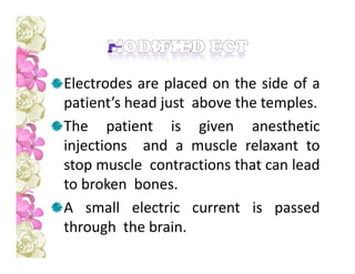Clinical teaching on electro convulsive therapy | PPT