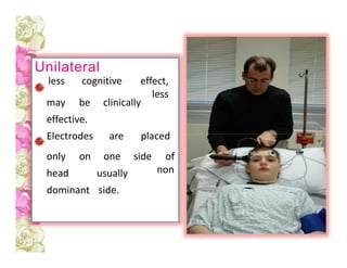 Clinical teaching on electro convulsive therapy | PPT
