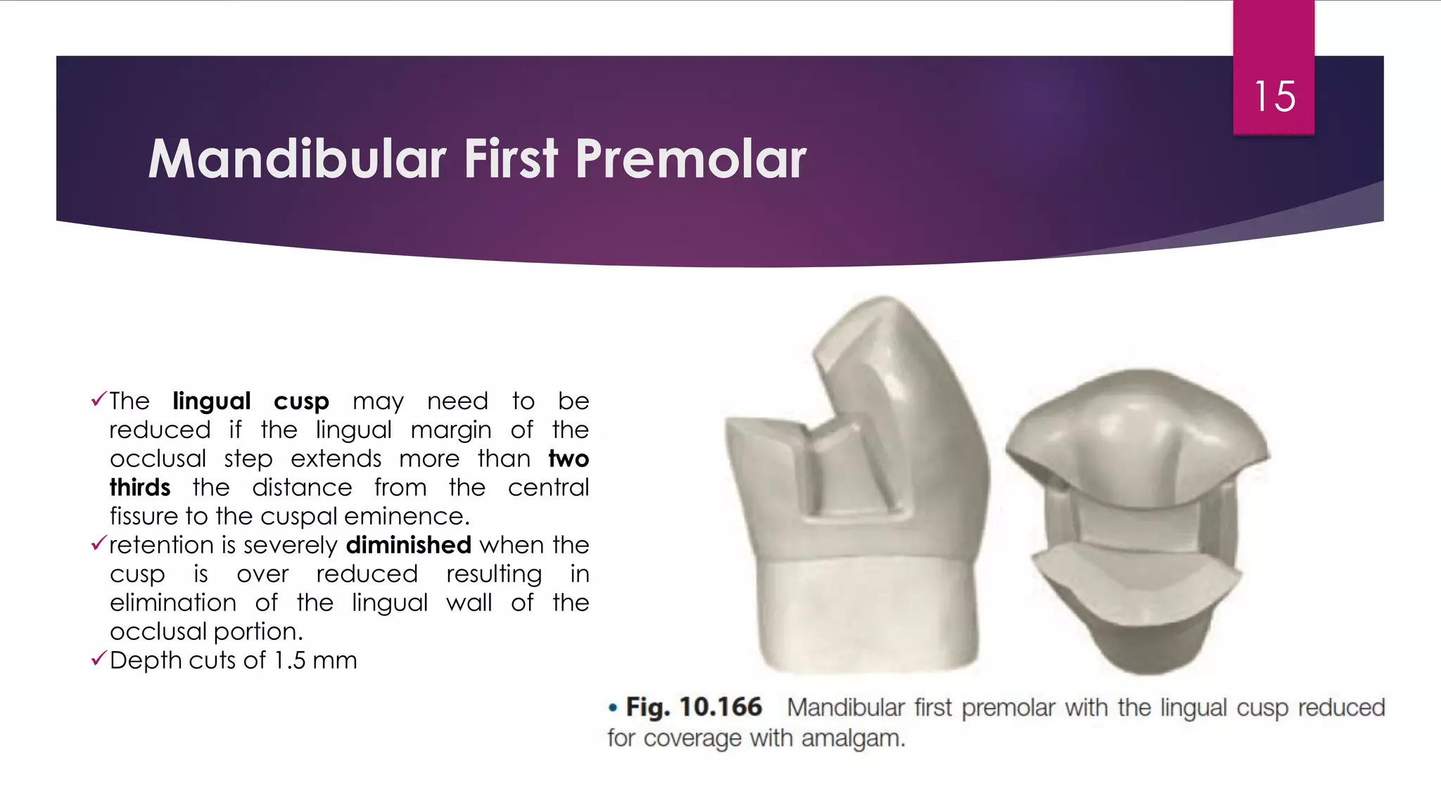 Clinical technique for complex Amalgam Restoration | PDF