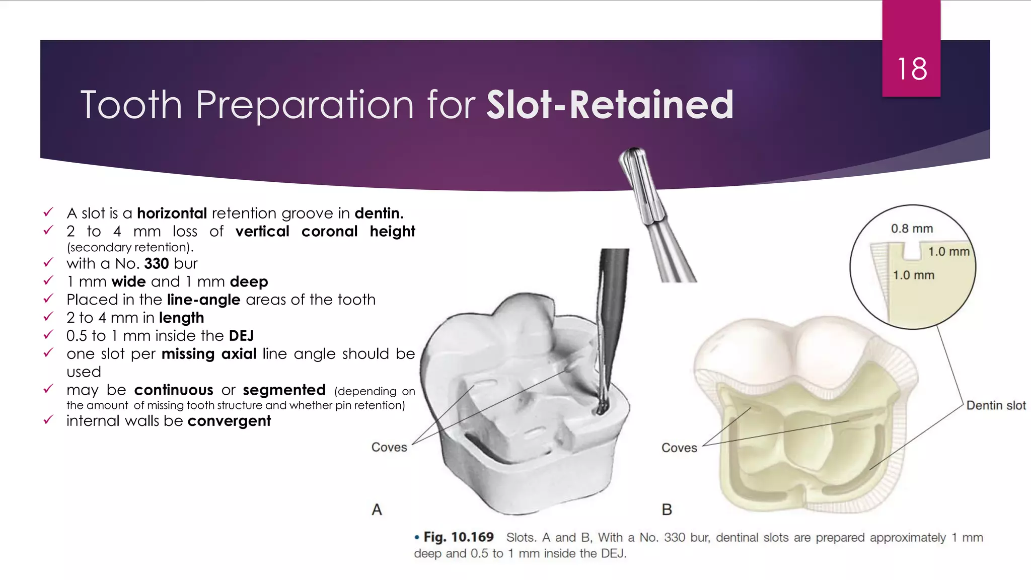 Clinical technique for complex Amalgam Restoration | PDF