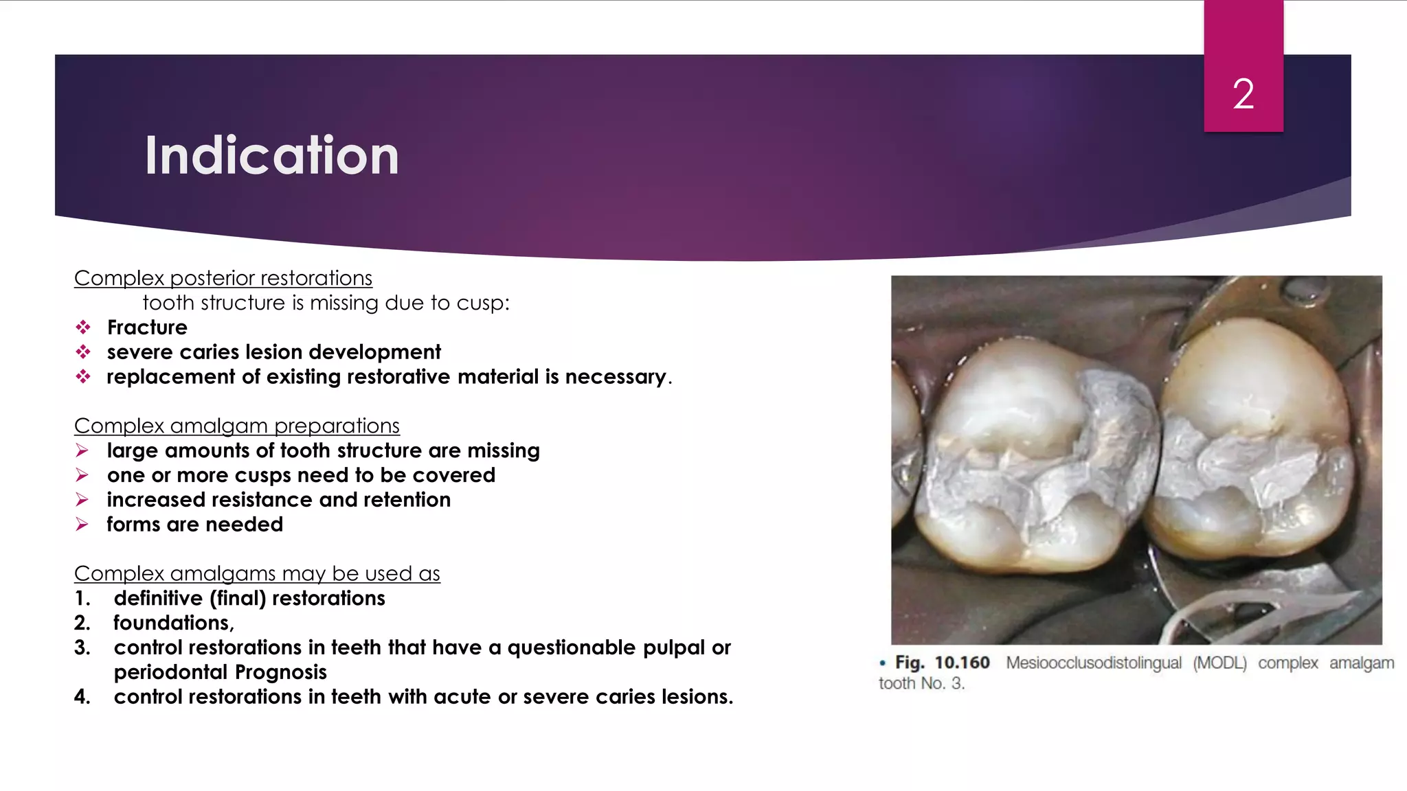 Clinical technique for complex Amalgam Restoration | PDF