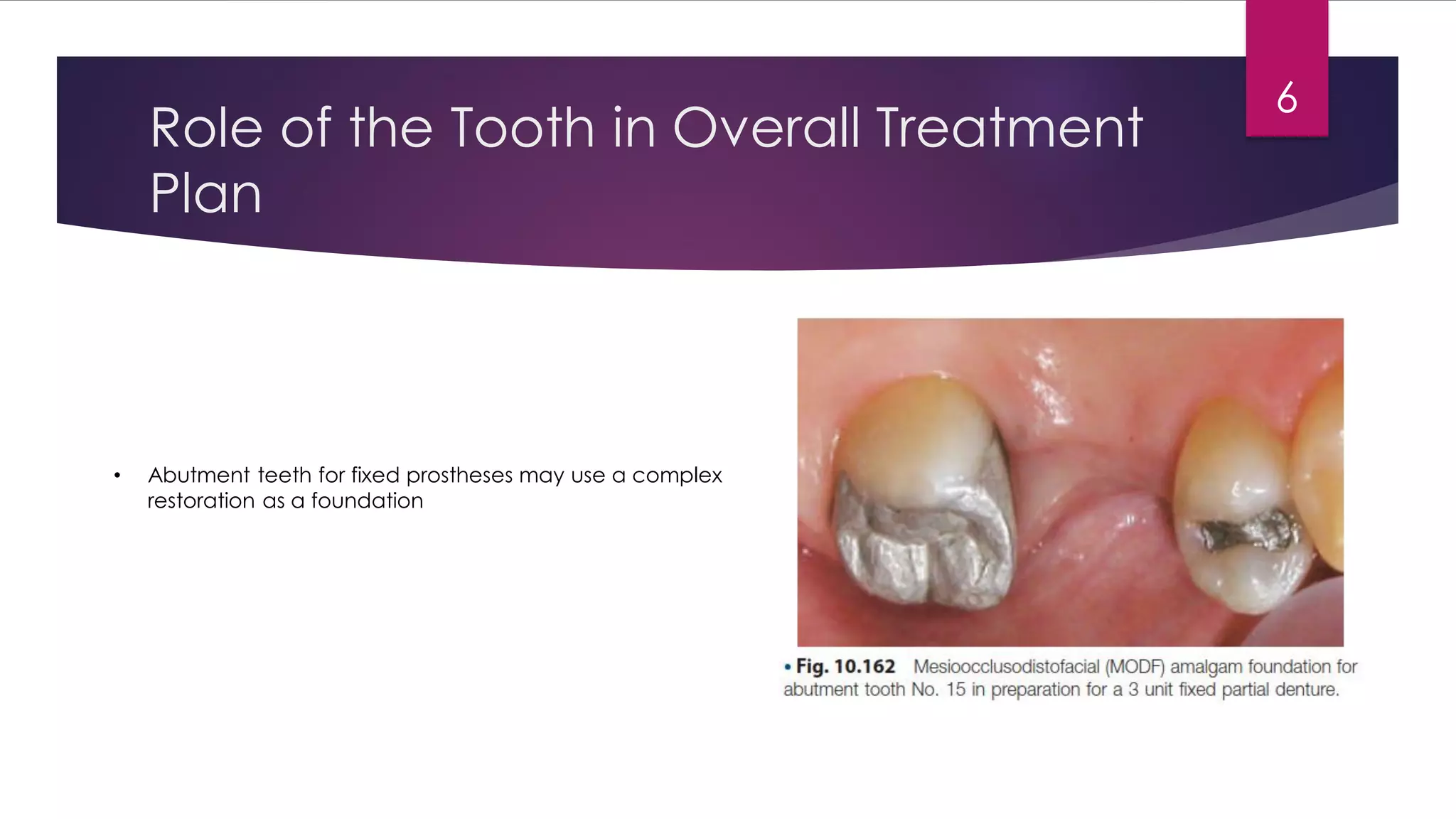 Clinical technique for complex Amalgam Restoration | PDF