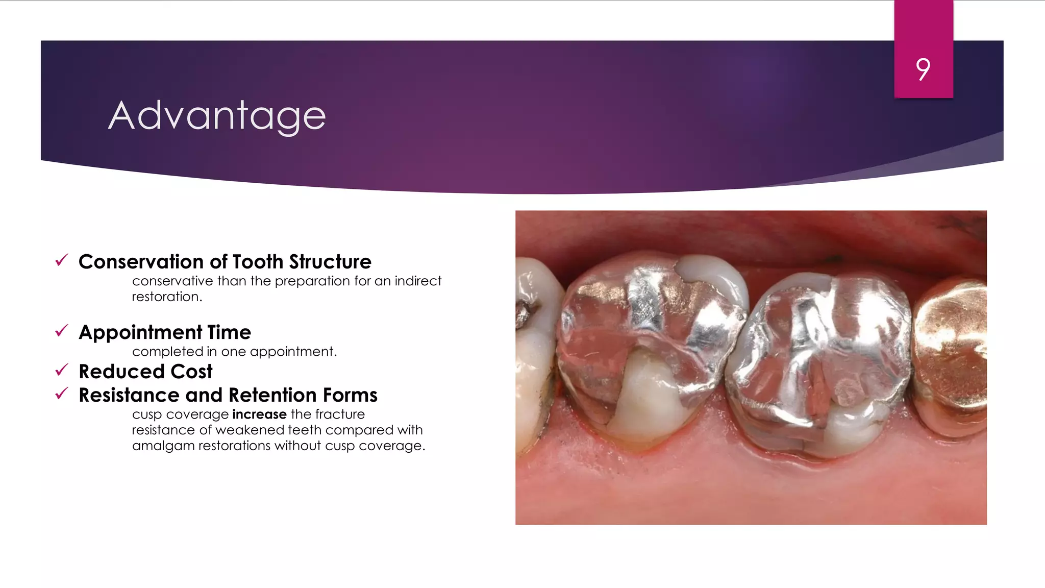 Clinical technique for complex Amalgam Restoration | PDF