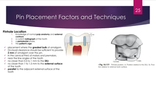 Clinical technique for complex Amalgam Restoration | PDF