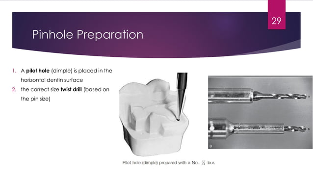 Clinical technique for complex Amalgam Restoration | PDF