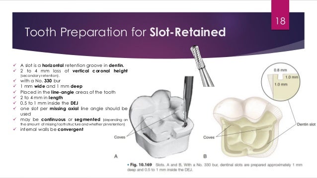 Clinical technique for complex Amalgam Restoration