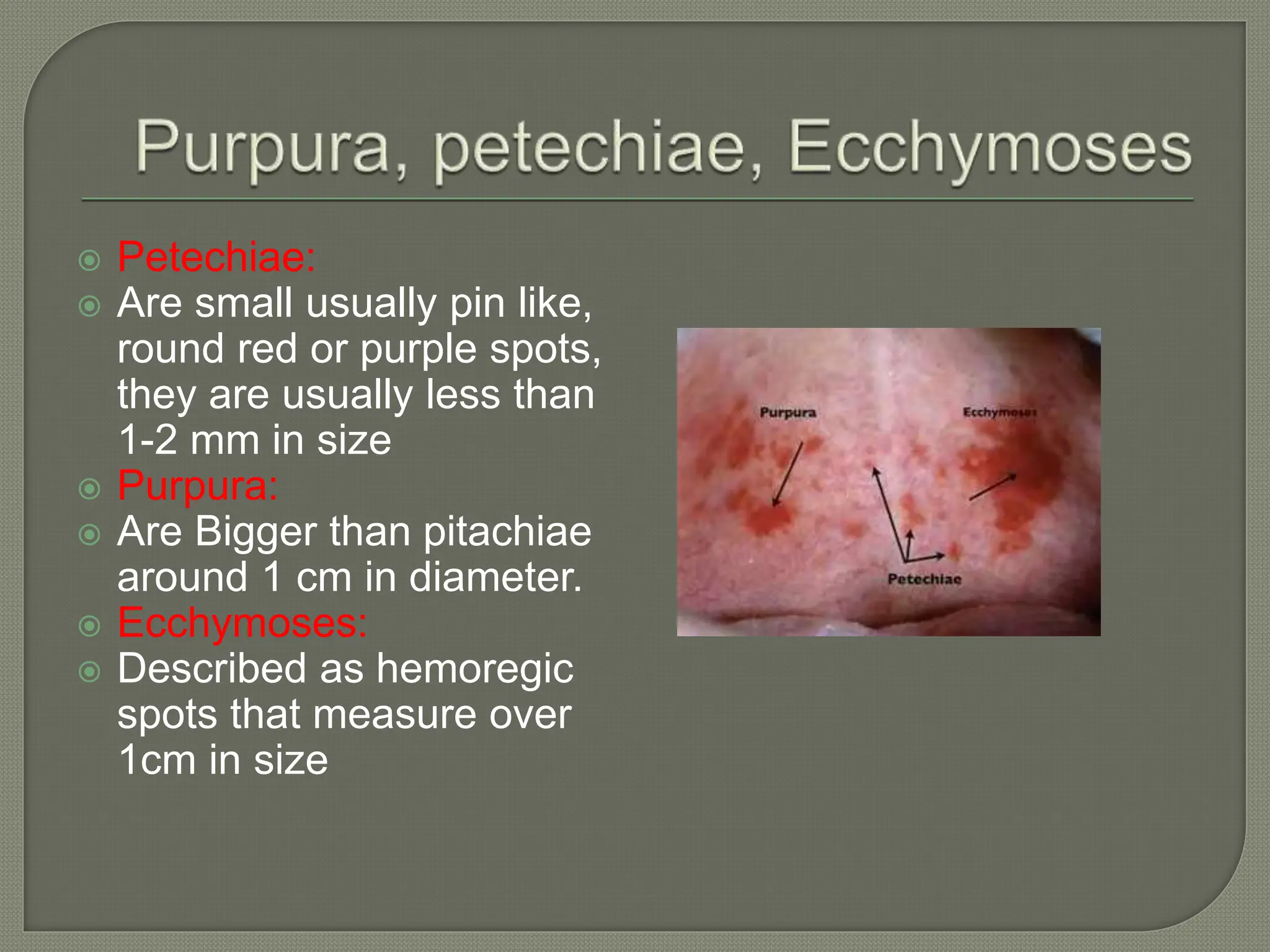 ORAL PATHOLOGY Clinical Terminologies.pptx