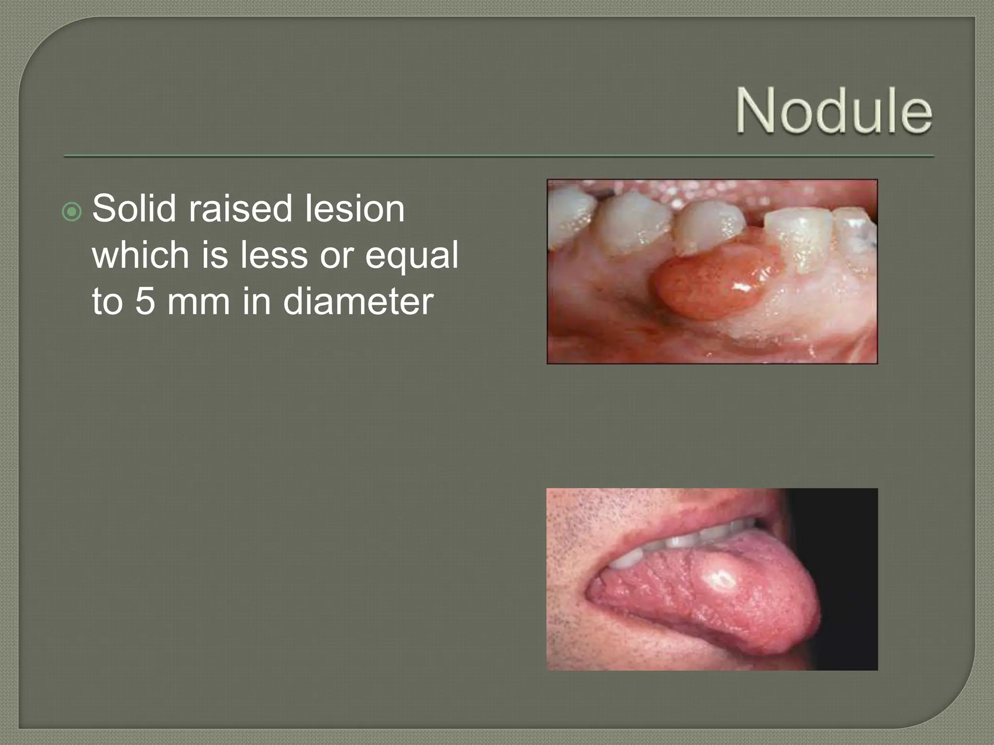 ORAL PATHOLOGY Clinical Terminologies.pptx
