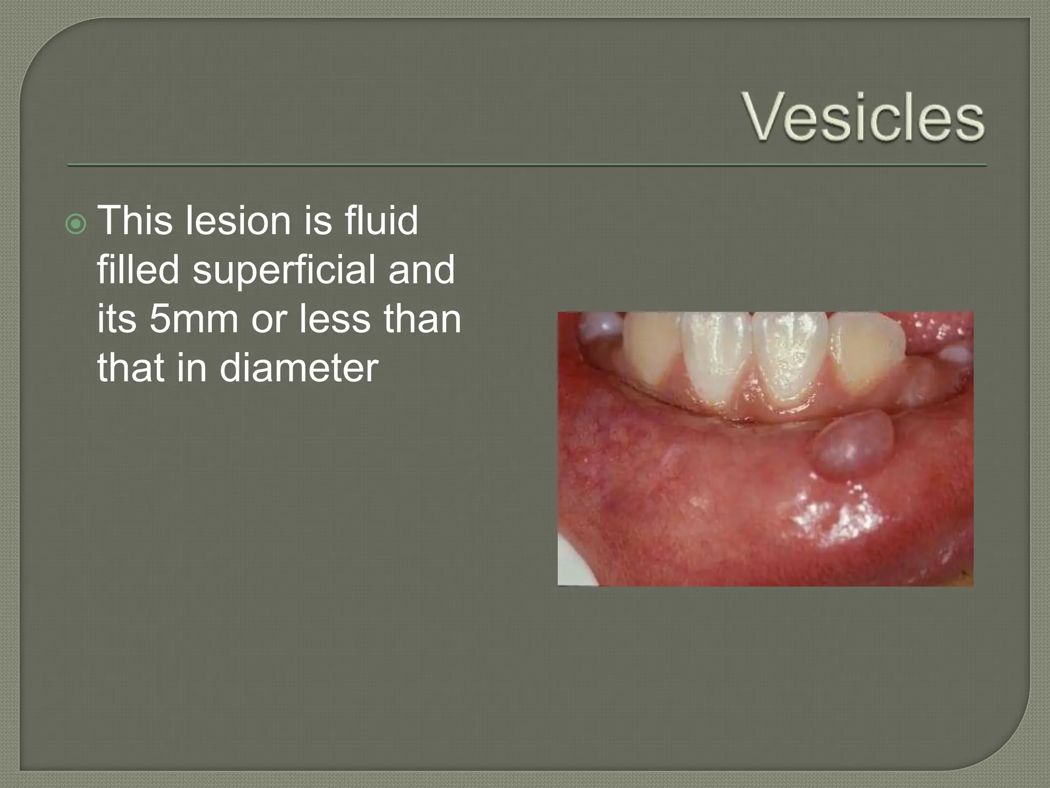 ORAL PATHOLOGY Clinical Terminologies.pptx
