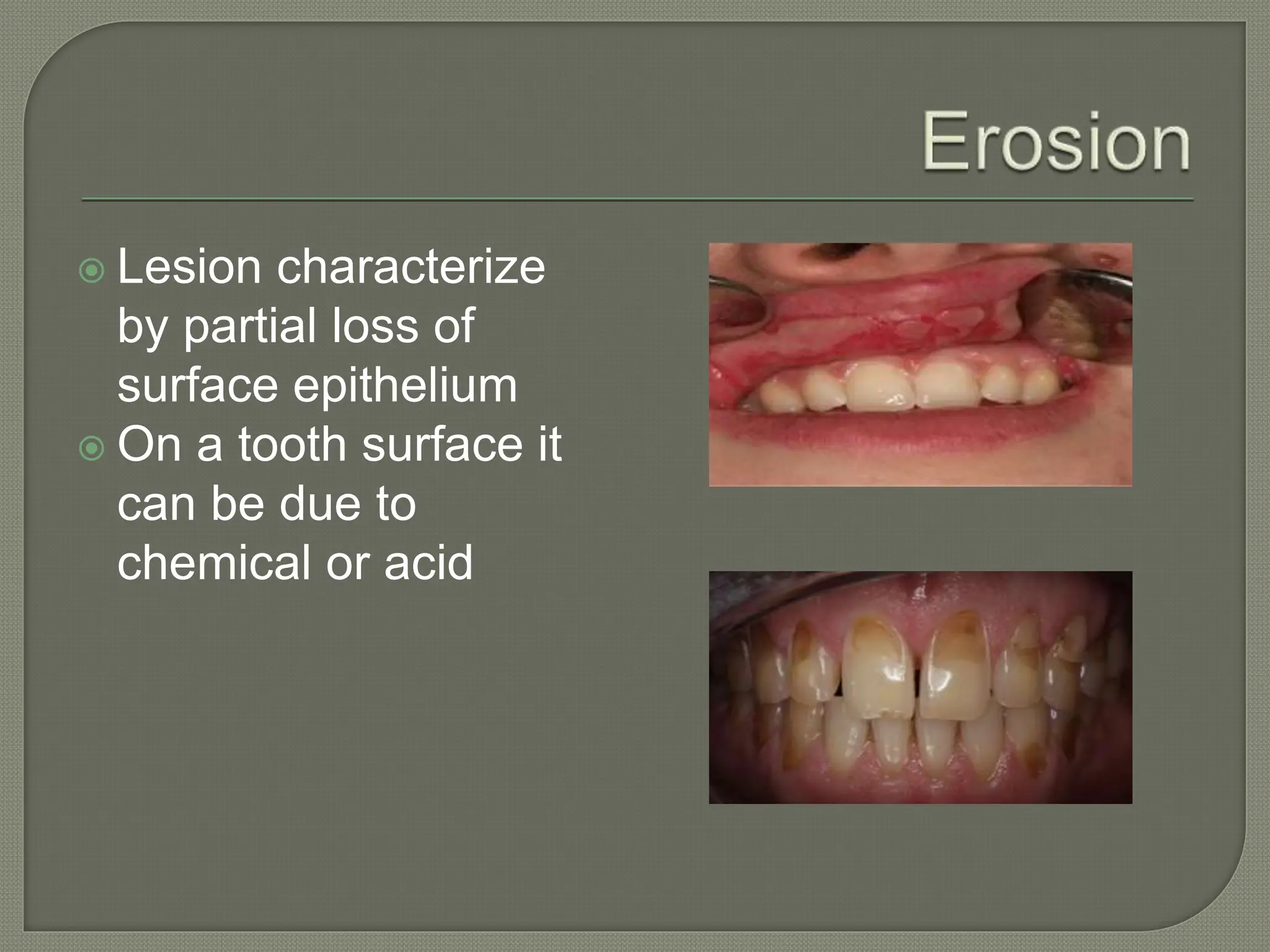 ORAL PATHOLOGY Clinical Terminologies.pptx