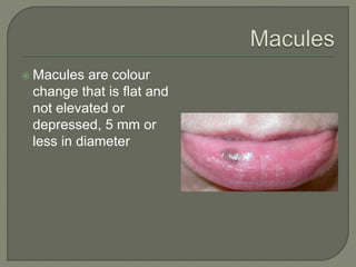 ORAL PATHOLOGY Clinical Terminologies.pptx