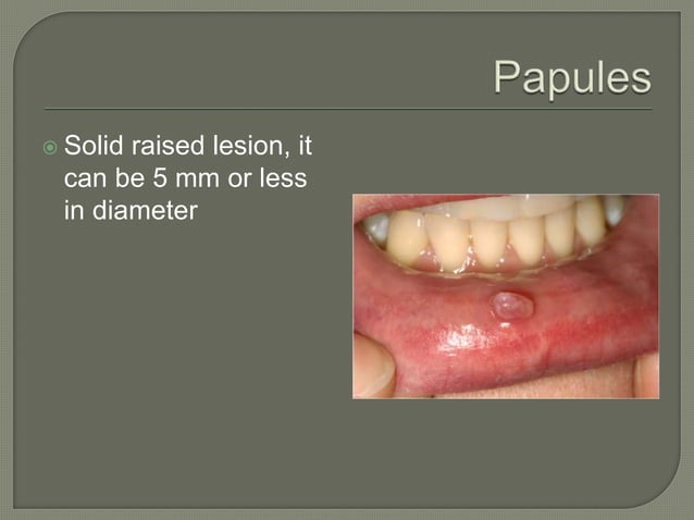 ORAL PATHOLOGY Clinical Terminologies.pptx