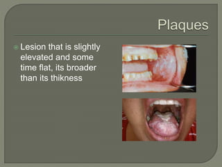 ORAL PATHOLOGY Clinical Terminologies.pptx