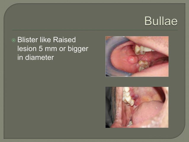 ORAL PATHOLOGY Clinical Terminologies.pptx