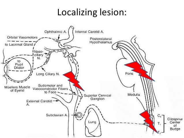 Clinical testing pupils