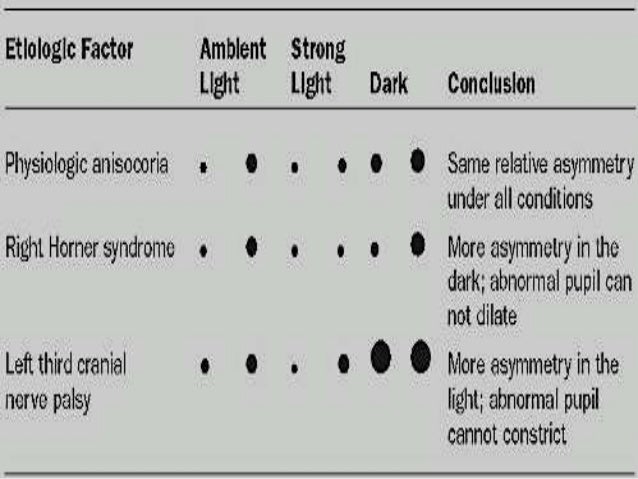 Brisk Pupil Reaction PPT Neurological Observations PowerPoint