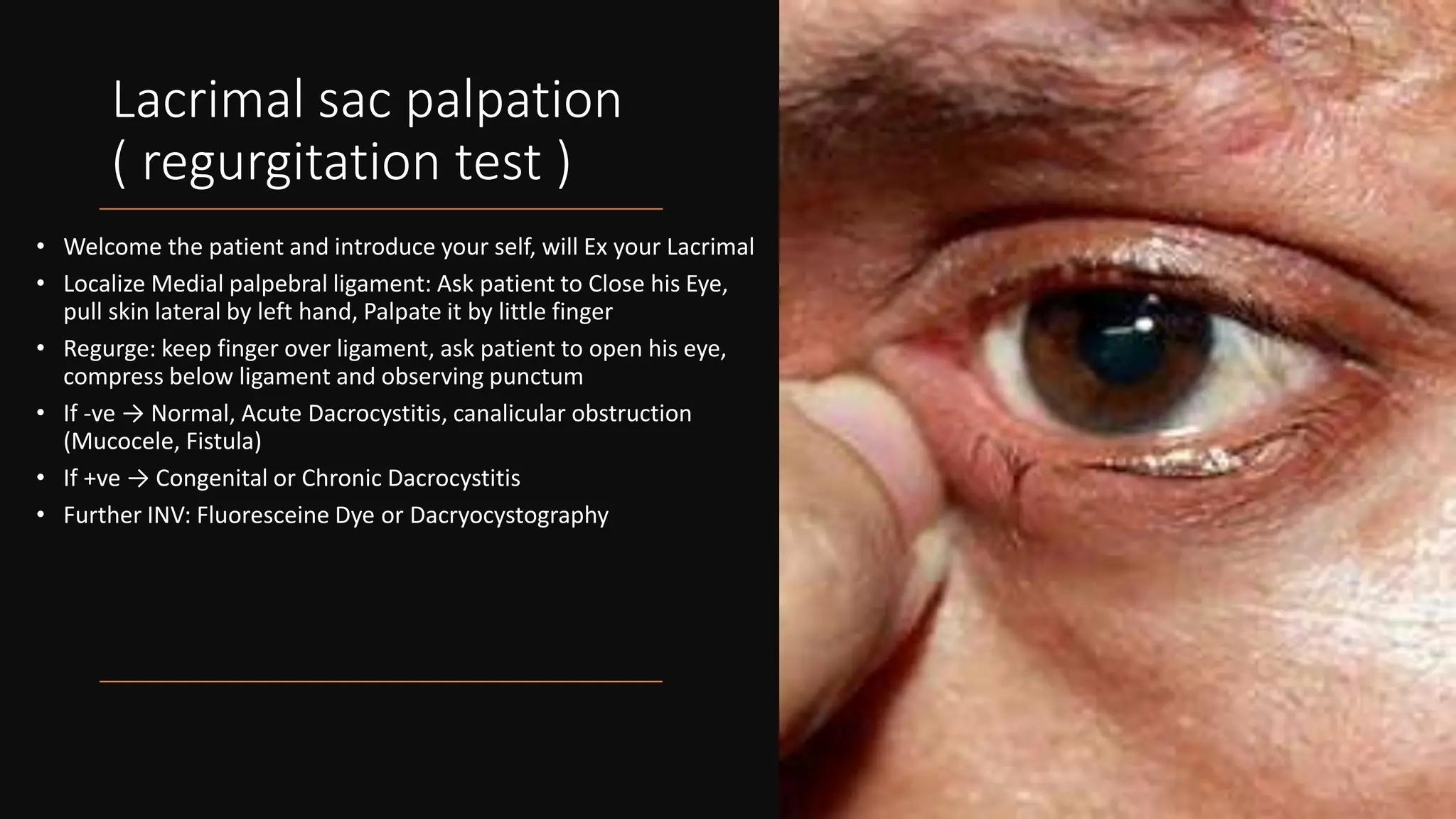 Ophthalmology Clinical Tests for OSCE exam | PPTX