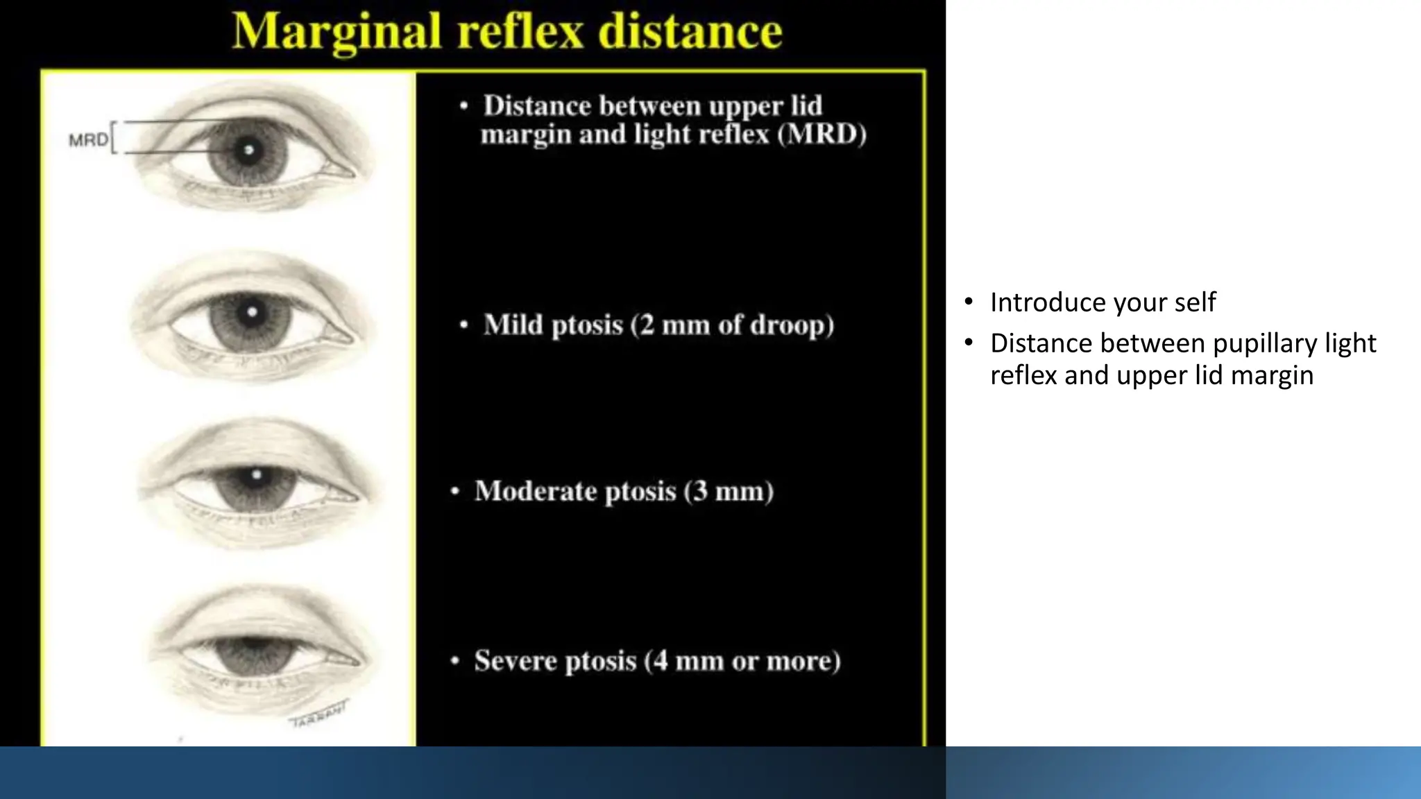 Ophthalmology Clinical Tests for OSCE exam | PPTX