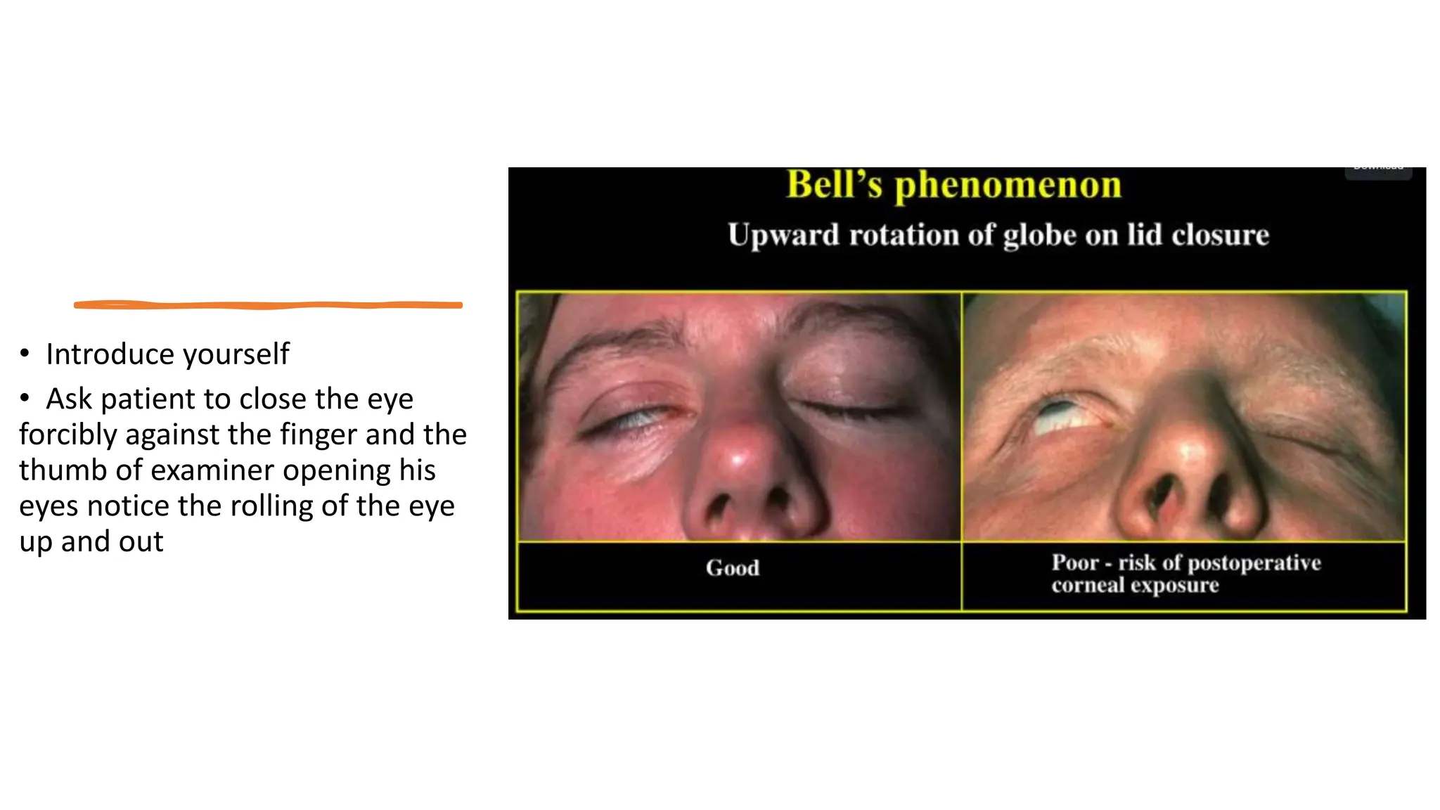 Ophthalmology Clinical Tests for OSCE exam | PPTX