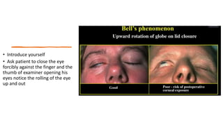 Ophthalmology Clinical Tests for OSCE exam | PPTX