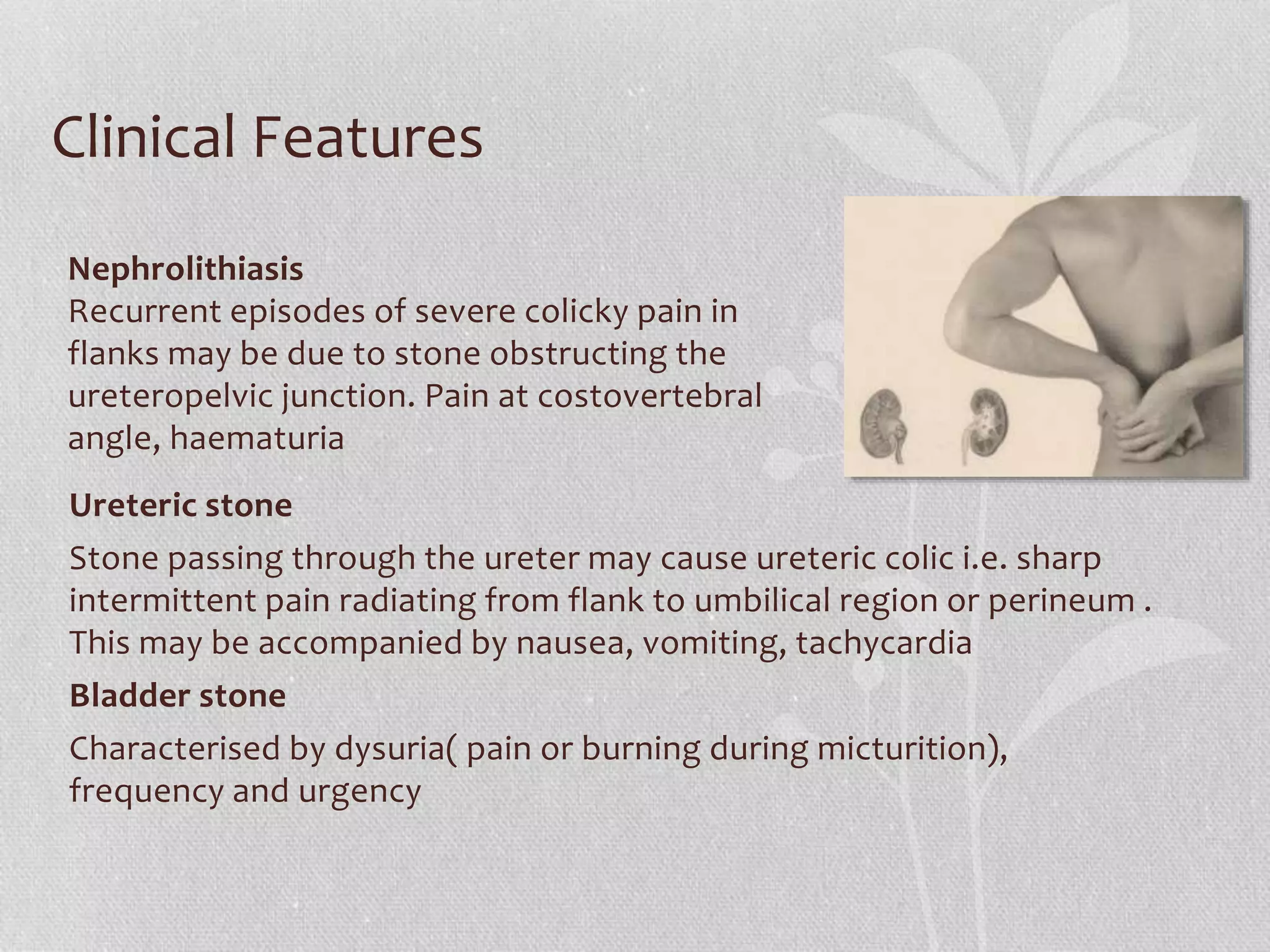 Clinical tips for the management of urolithiasis | PPTX