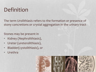 Clinical tips for the management of urolithiasis | PPT