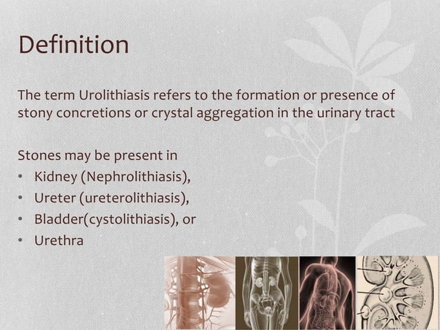 Clinical tips for the management of urolithiasis | PPT