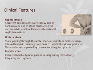 Clinical tips for the management of urolithiasis | PPT