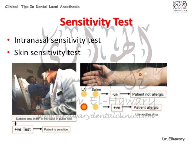 Clinical tips in dental local anesthesia