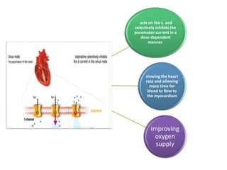 Clinical trial ivabradine | PPT