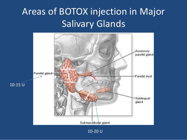 Clinical use of botulinum toxins in omfs