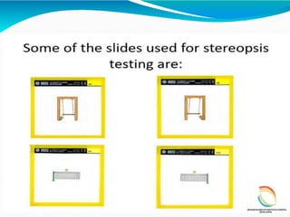 Optom Anamul Haq( synoptophore) | PPT