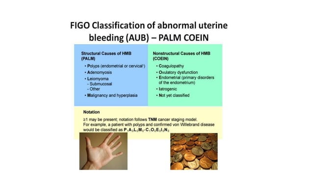 Clinical Utility of PALM-COEIN Classification for AUB 25 Juli 18.pptx.pdf
