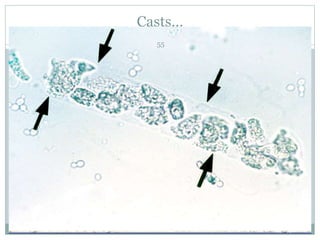Clinical utility of urinalysis | PPTX