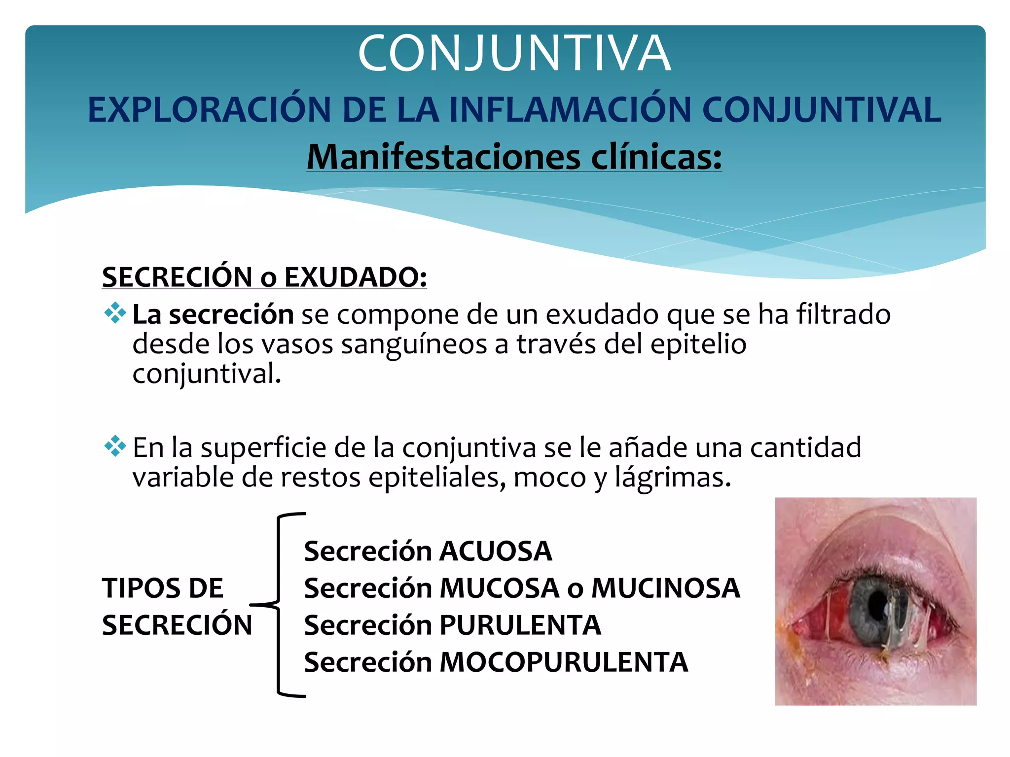 Clínica oftalmológica pregrado tema Conjuntiva | PPT