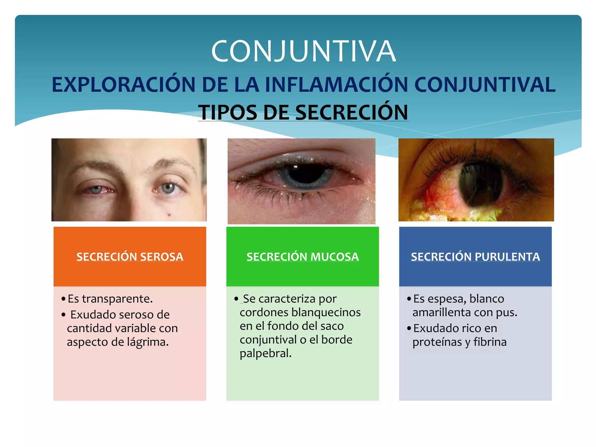 Clínica oftalmológica pregrado tema Conjuntiva | PPT