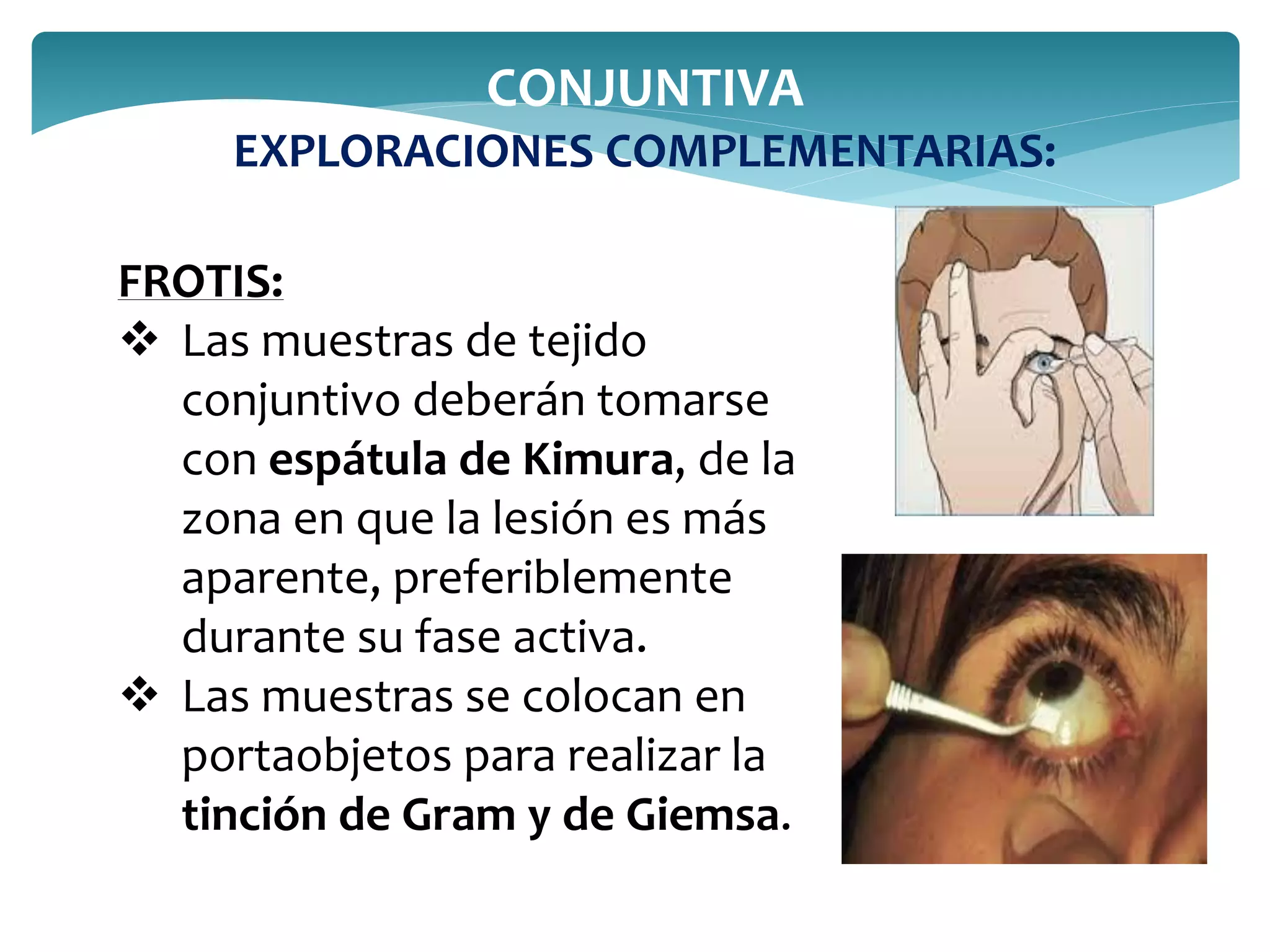 Clínica oftalmológica pregrado tema Conjuntiva | PPT