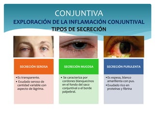 Clínica oftalmológica pregrado tema Conjuntiva | PDF