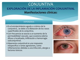 Clínica oftalmológica pregrado tema Conjuntiva | PDF